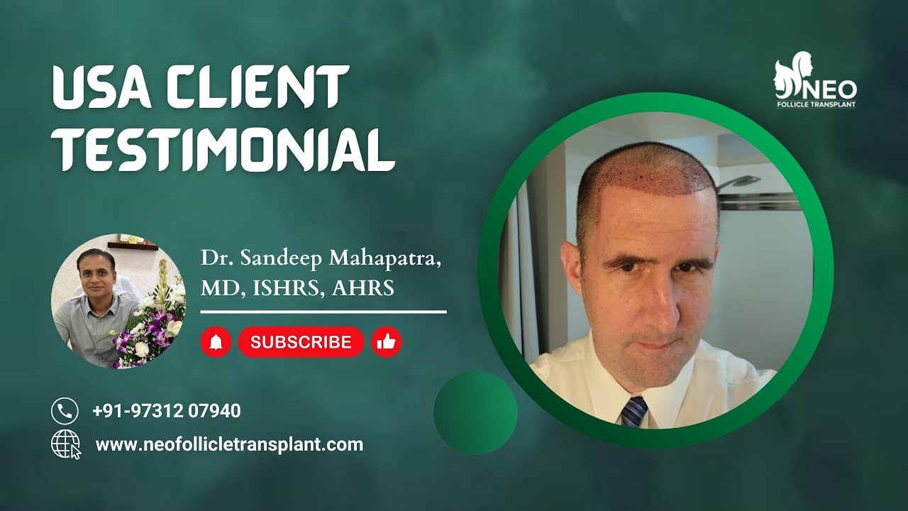 Hair Transplant in India for International Patients